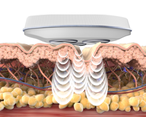Kavys - Aparelho de Ultracavitação Tripla - KLD Biosistemas